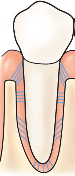 CARLETON PLACE DENTISTS ALMONTE: After Orthodontics (Braces), Do Teeth ...